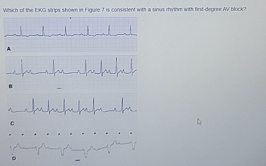 Which of the EKG strips shown in Figure 7 is