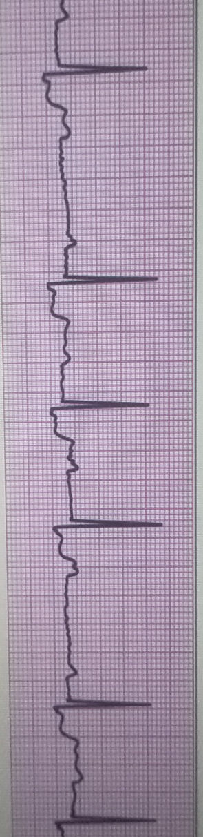 The image shows an ECG (electrocardiogram) | StudyX