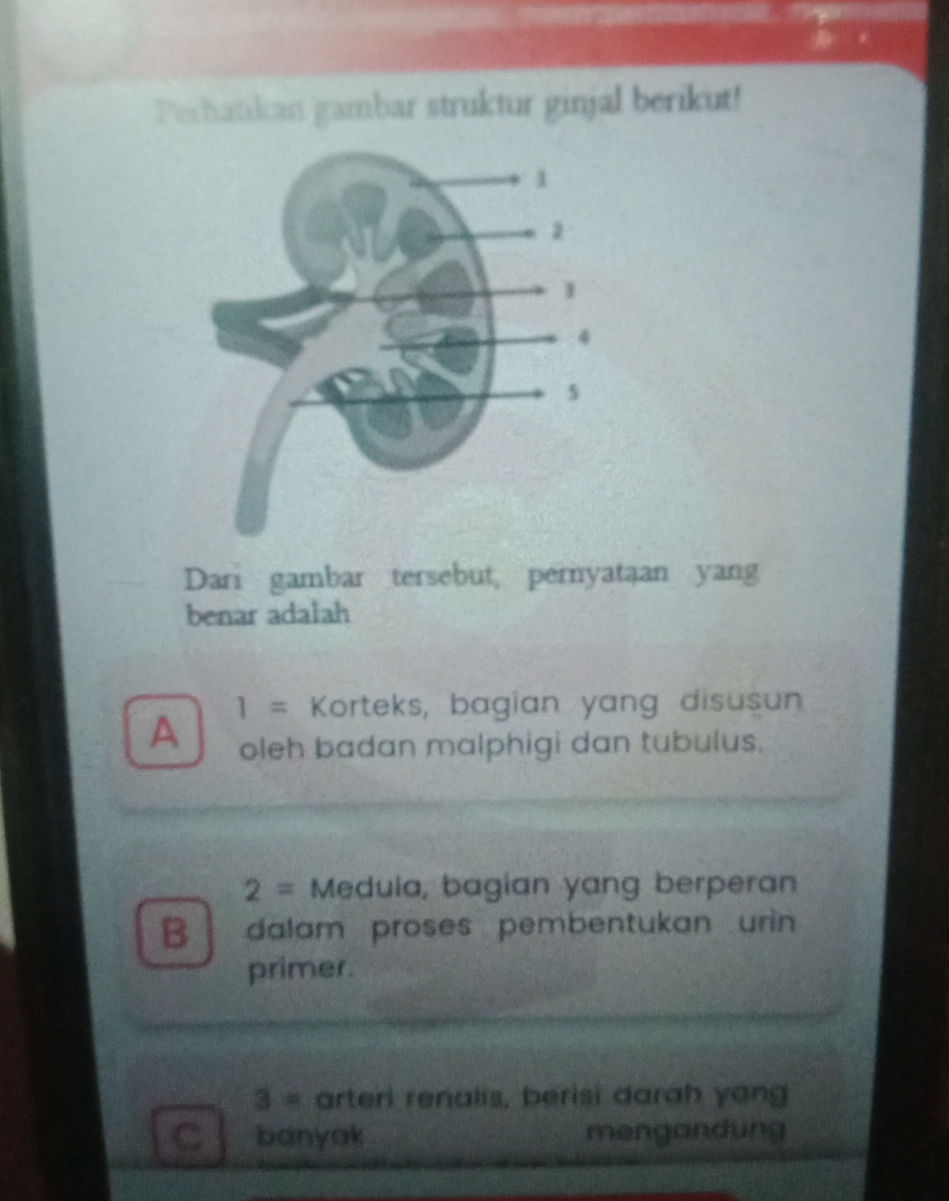 Perhatikan gambar struktur ginjal berikut! | StudyX