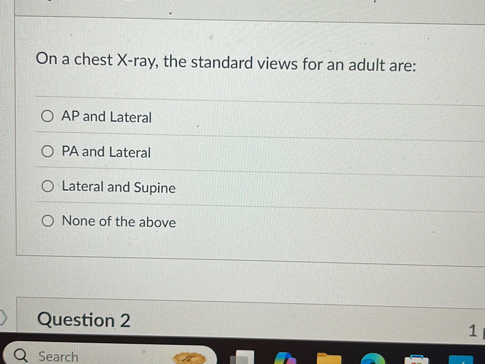 On a chest X-ray, the standard views for an | StudyX