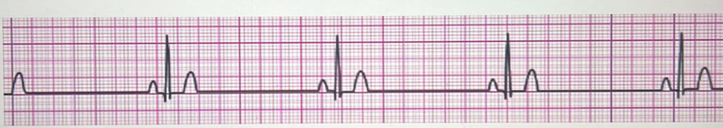 The image shows an electrocardiogram (ECG) | StudyX