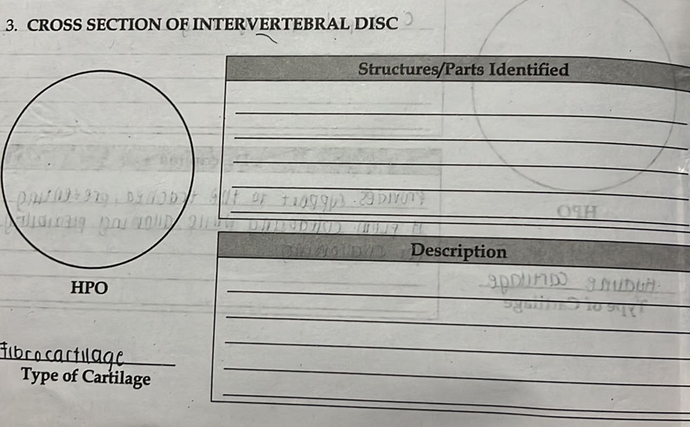 CROSS SECTION OF INTERVERTEBRAL DISC HPO | StudyX
