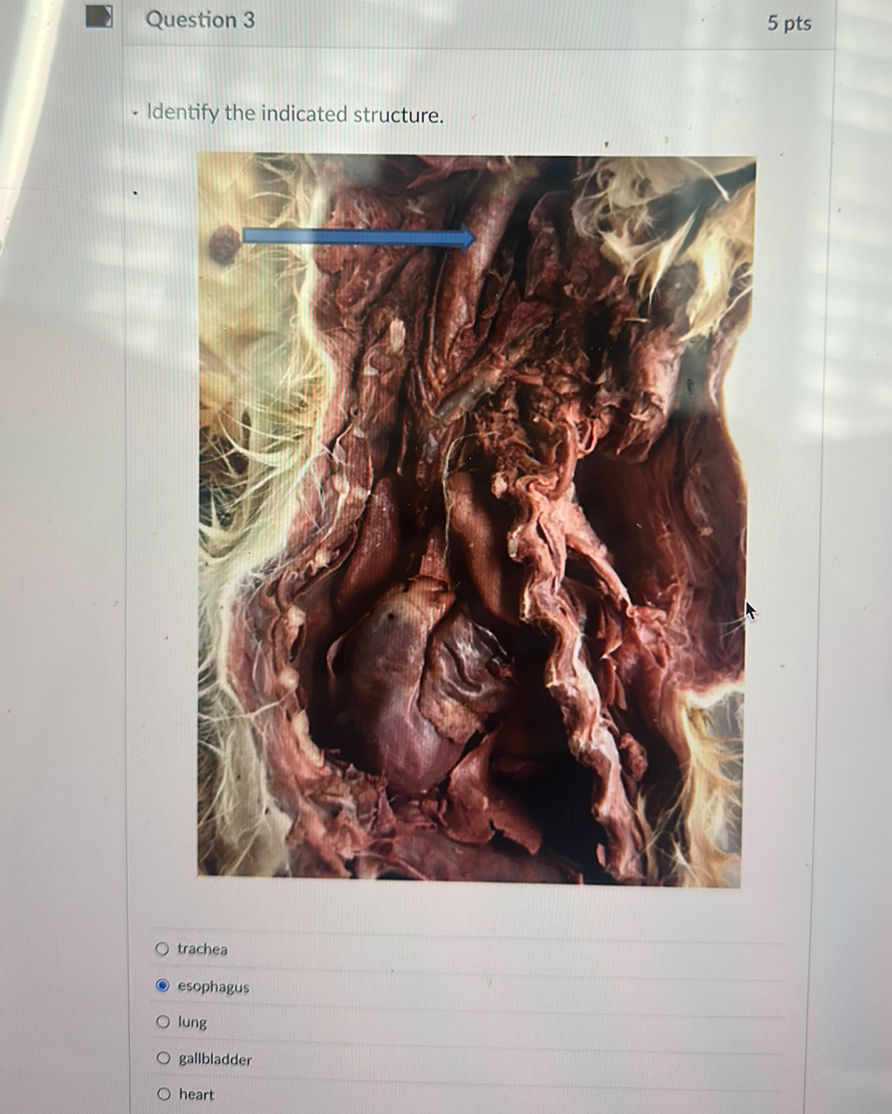 Identify the indicated structure. * | StudyX