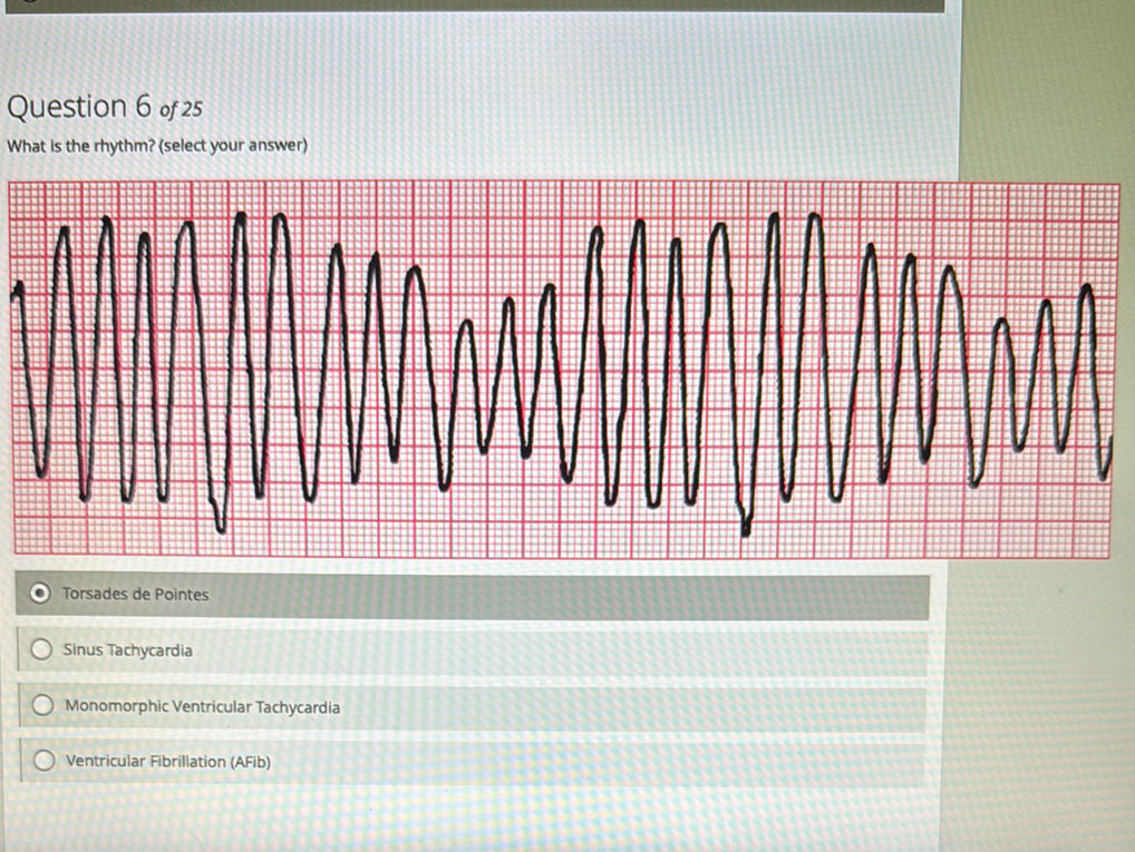 What is the rhythm? (select your answer) | StudyX