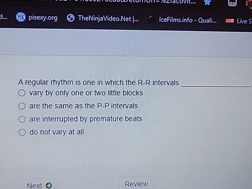 A regular rhythm is one in which the R-R | StudyX