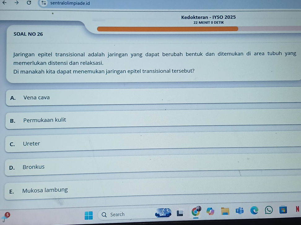 Jaringan epitel transisional adalah jaringan | StudyX
