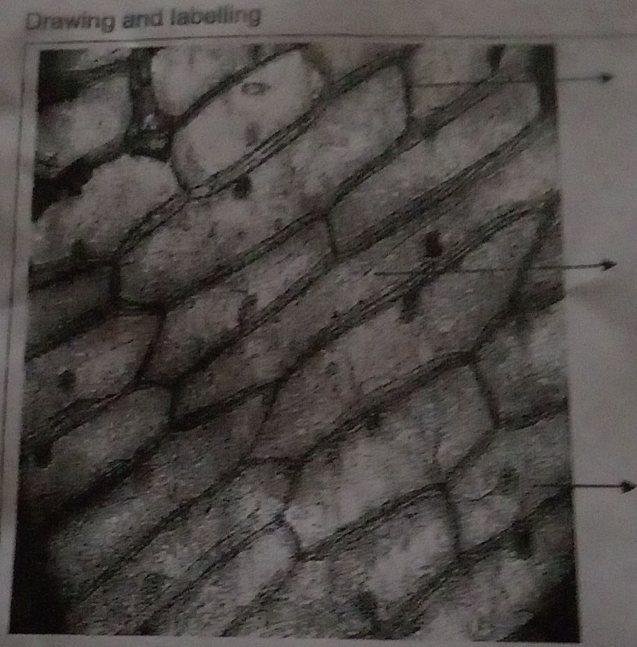 The image shows a microscopic view of onion | StudyX