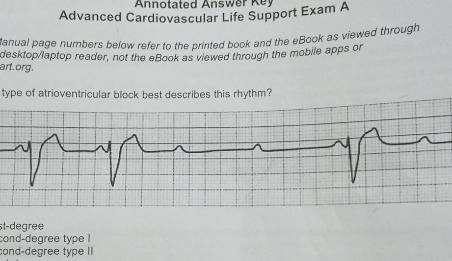 What type of atrioventricular block best | StudyX