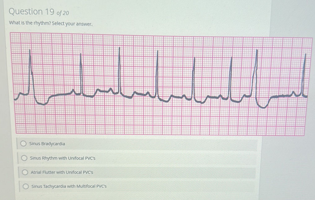 Question 19 of 20 What is the rhythm? Select | StudyX