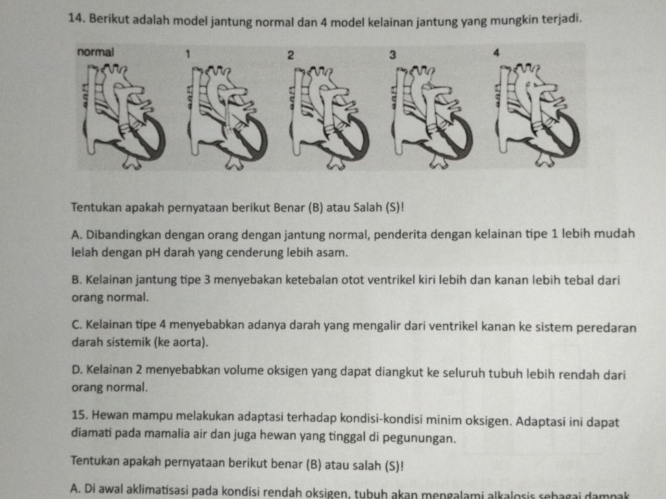 14. Berikut adalah model jantung normal dan | StudyX