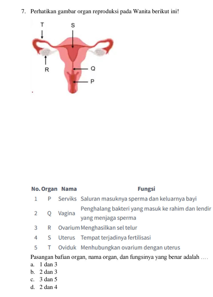 7. Perhatikan gambar organ reproduksi pada | StudyX