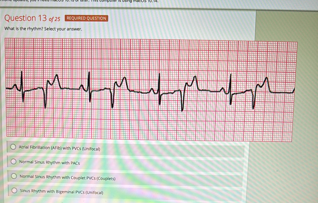 Question 13 of 25 REQUIRED QUESTION What is | StudyX
