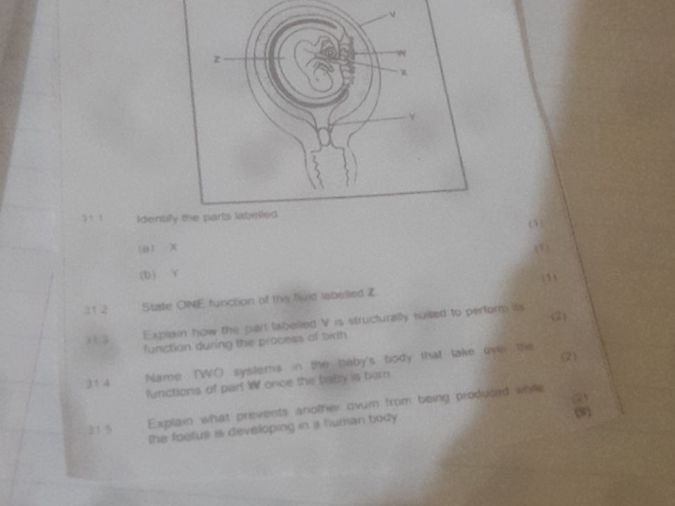 31.1 Identify the parts labelled (a) X (b) Y | StudyX