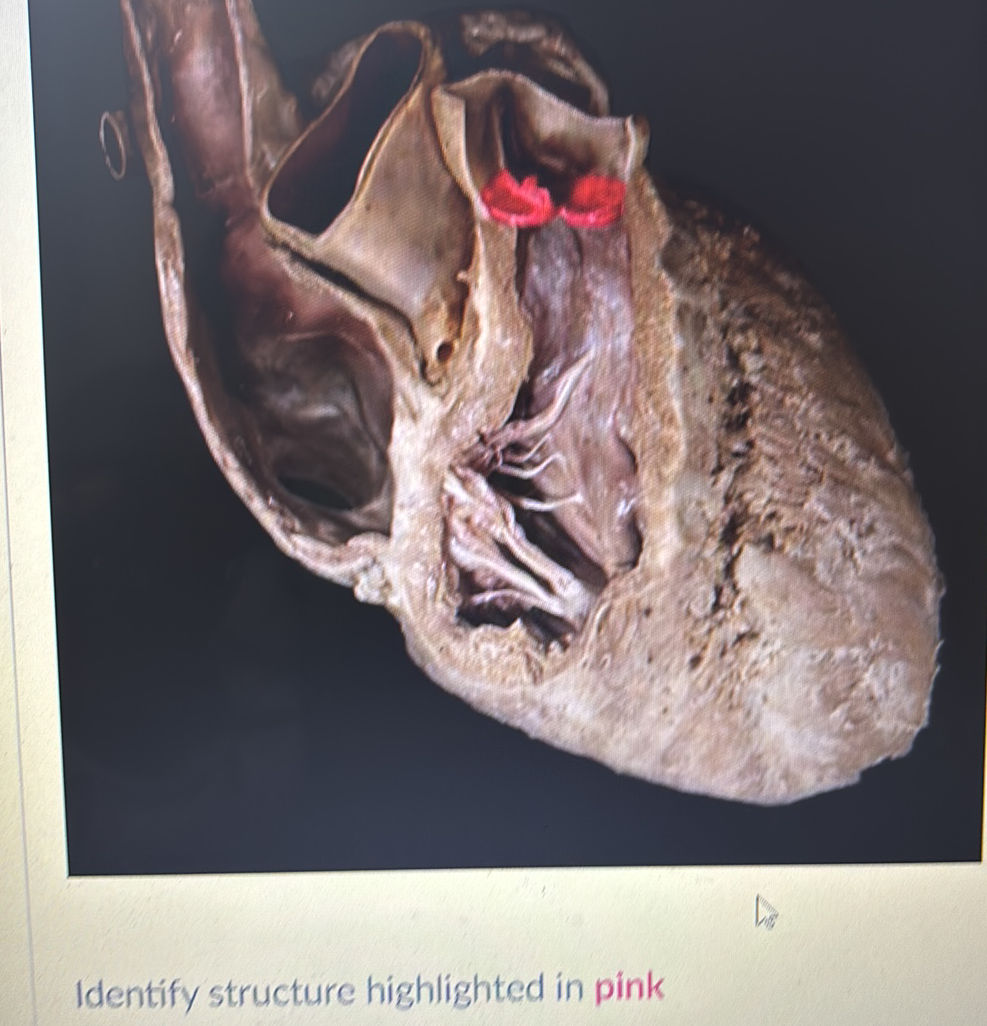 Identify heart structure highlighted in pink | StudyX