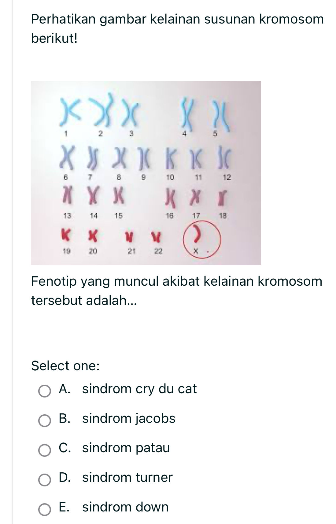 Perhatikan gambar kelainan susunan kromosom | StudyX