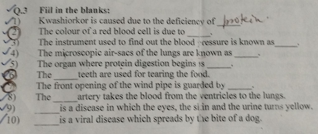Q.3 Fill in the blanks: 1) Kwashiorkor is | StudyX