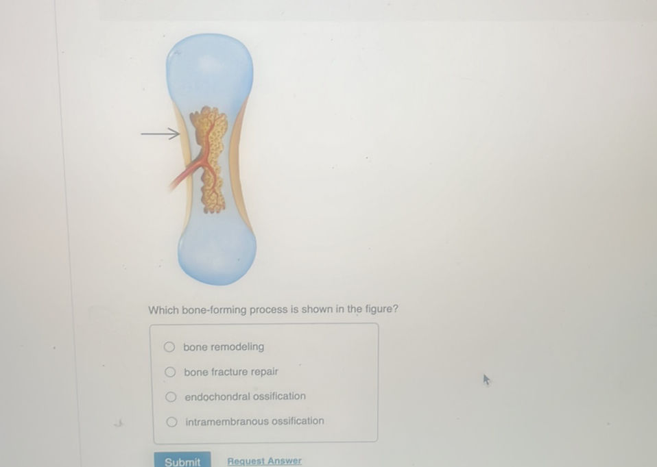 Which bone-forming process is shown in the | StudyX