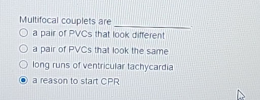Multifocal couplets are a pair of PVCs that | StudyX