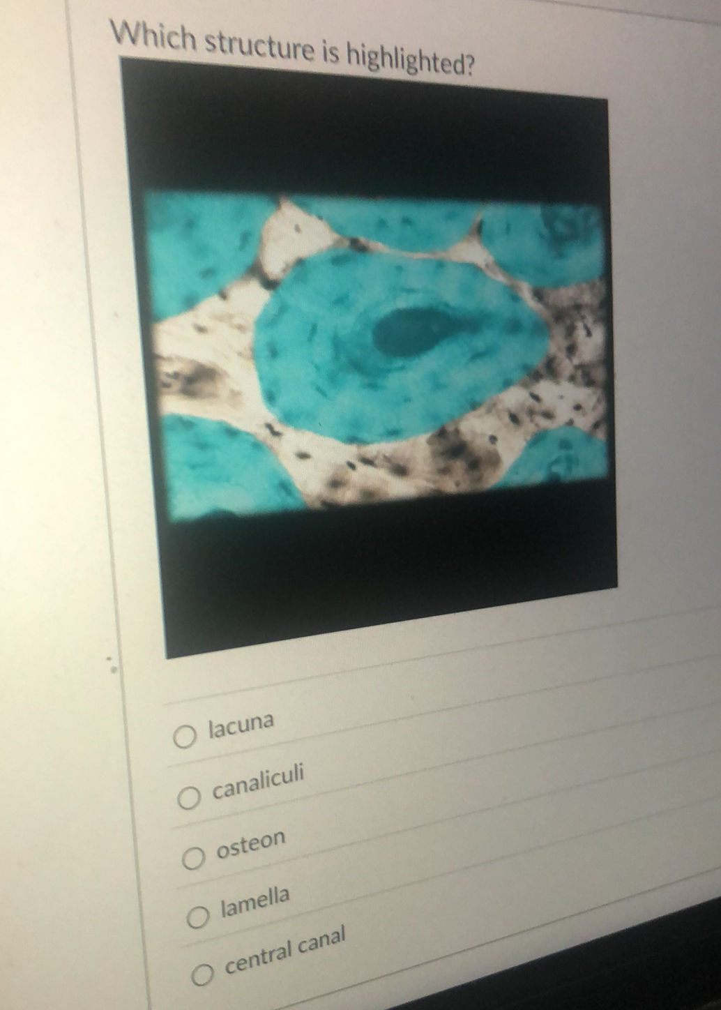 Which structure is highlighted? lacuna | StudyX