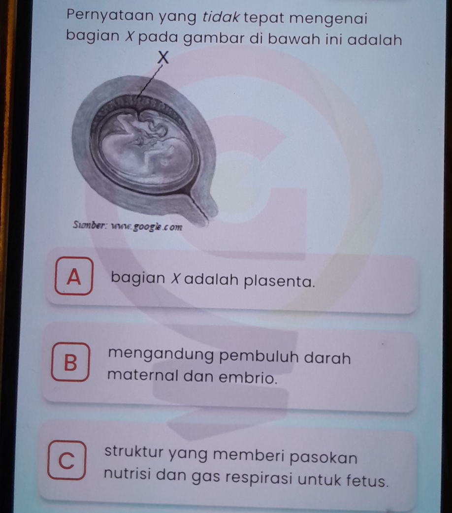 Pernyataan yang tidak tepat mengenai bagian | StudyX