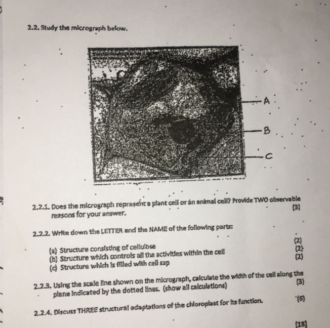2.2. Study the micrograph below. (Image of | StudyX