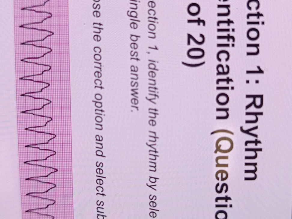 Section 1: Rhythm Identification (Question | StudyX