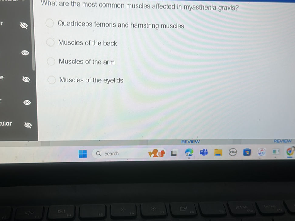 What are the most common muscles affected in | StudyX