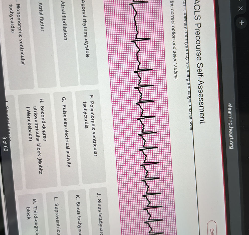 Identify the rhythm by selecting the single | StudyX