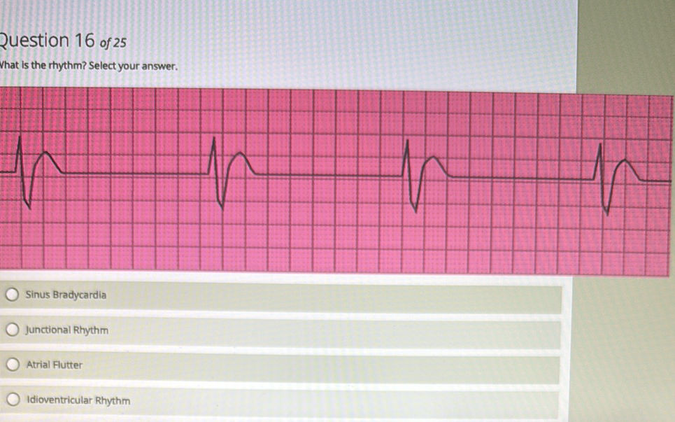 Question 16 of 25 What is the rhythm? Select | StudyX