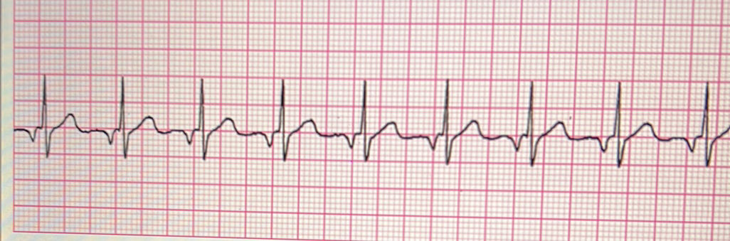 The image shows an electrocardiogram (ECG) | StudyX