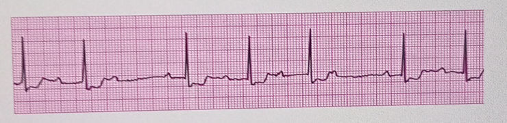 The image shows an electrocardiogram (ECG) | StudyX