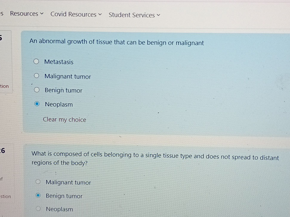 An abnormal growth of tissue that can be