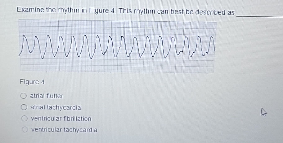 Examine the rhythm in Figure 4. This rhythm | StudyX