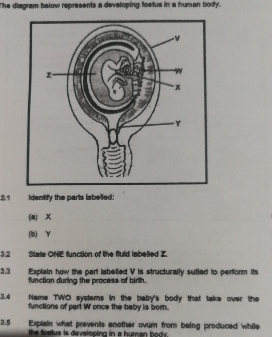 The diagram below represents a developing | StudyX