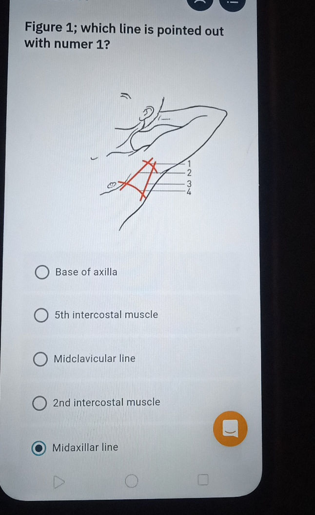 Figure 1; which line is pointed out with | StudyX