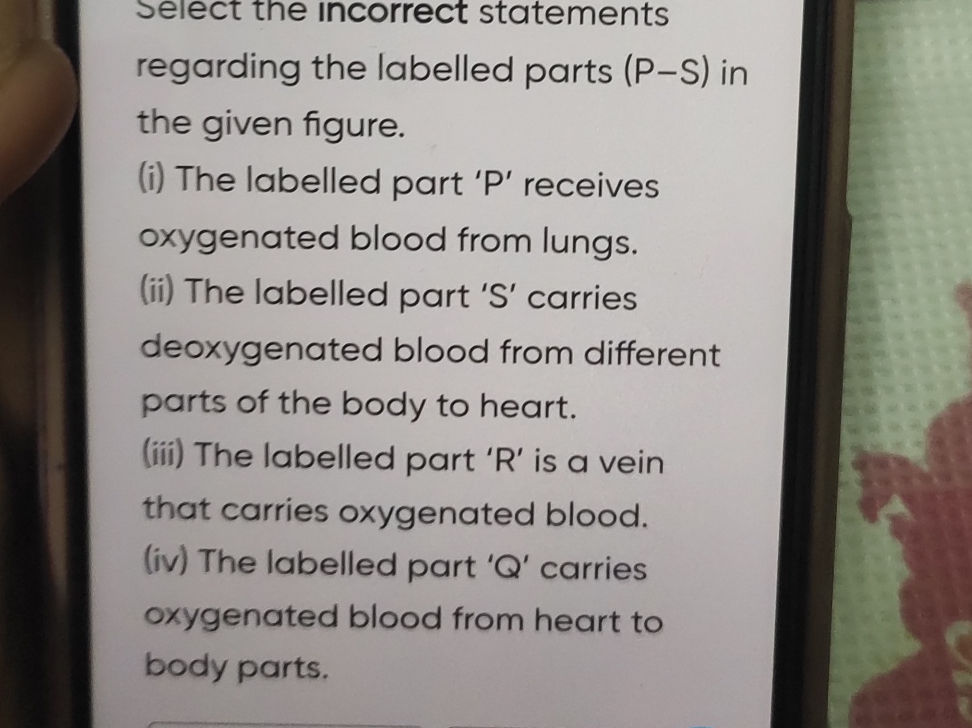 Select the incorrect statements regarding | StudyX