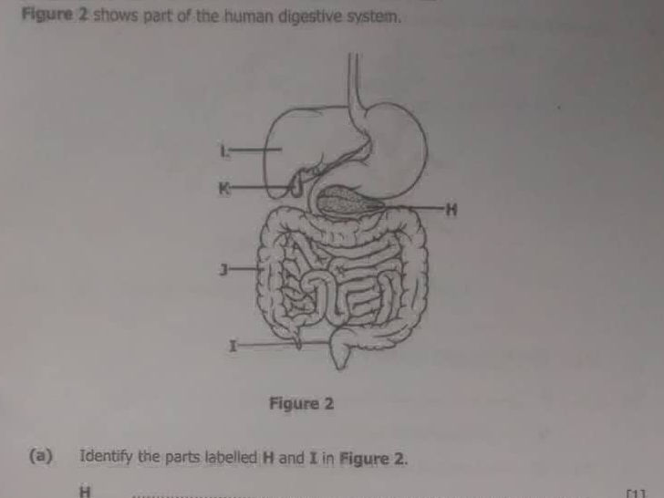Figure 2 shows part of the human digestive | StudyX