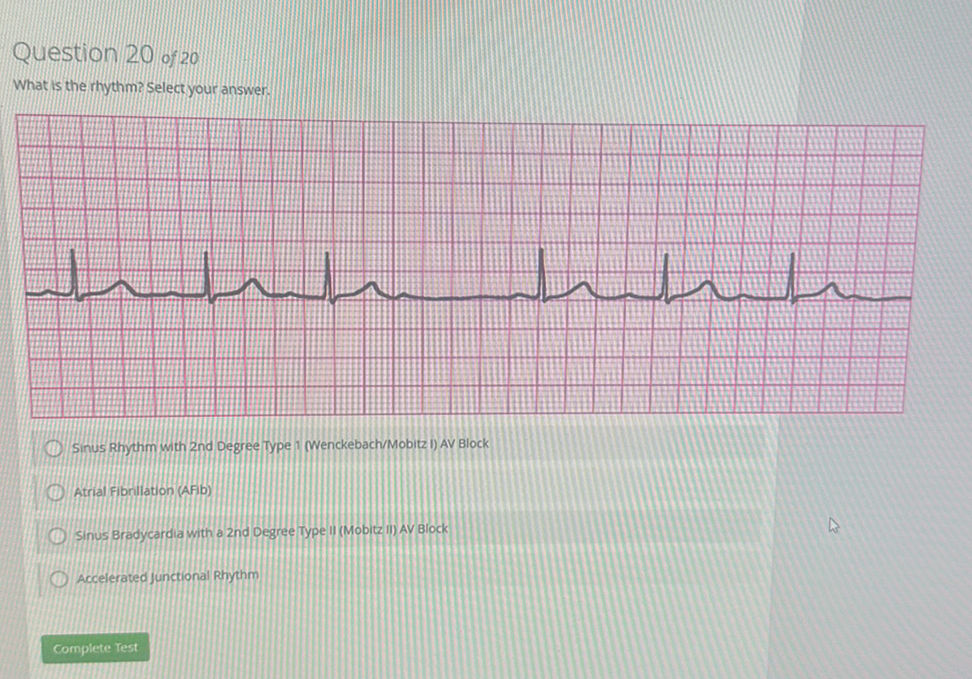 Question 20 of 20 What is the rhythm? Select