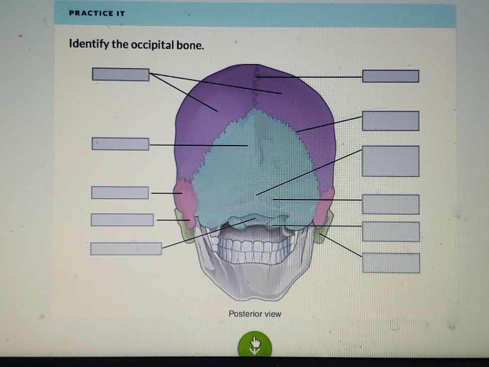 Identify the occipital bone. (Image of a | StudyX
