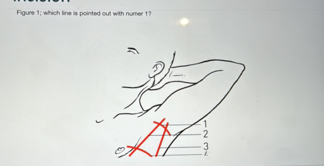 Figure 1 which line is pointed out with | StudyX