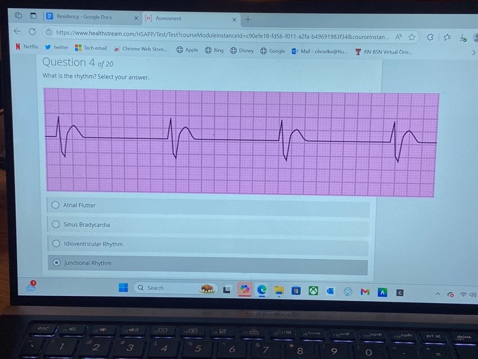 Question 4 of 20 What is the rhythm? Select | StudyX