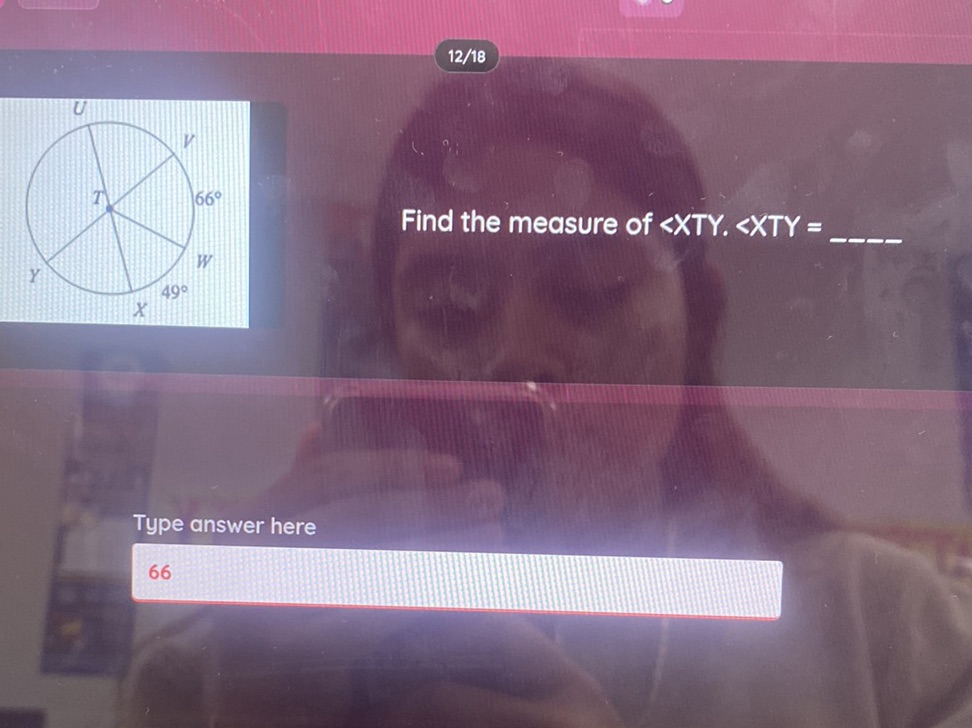 Find the measure of angle XTY