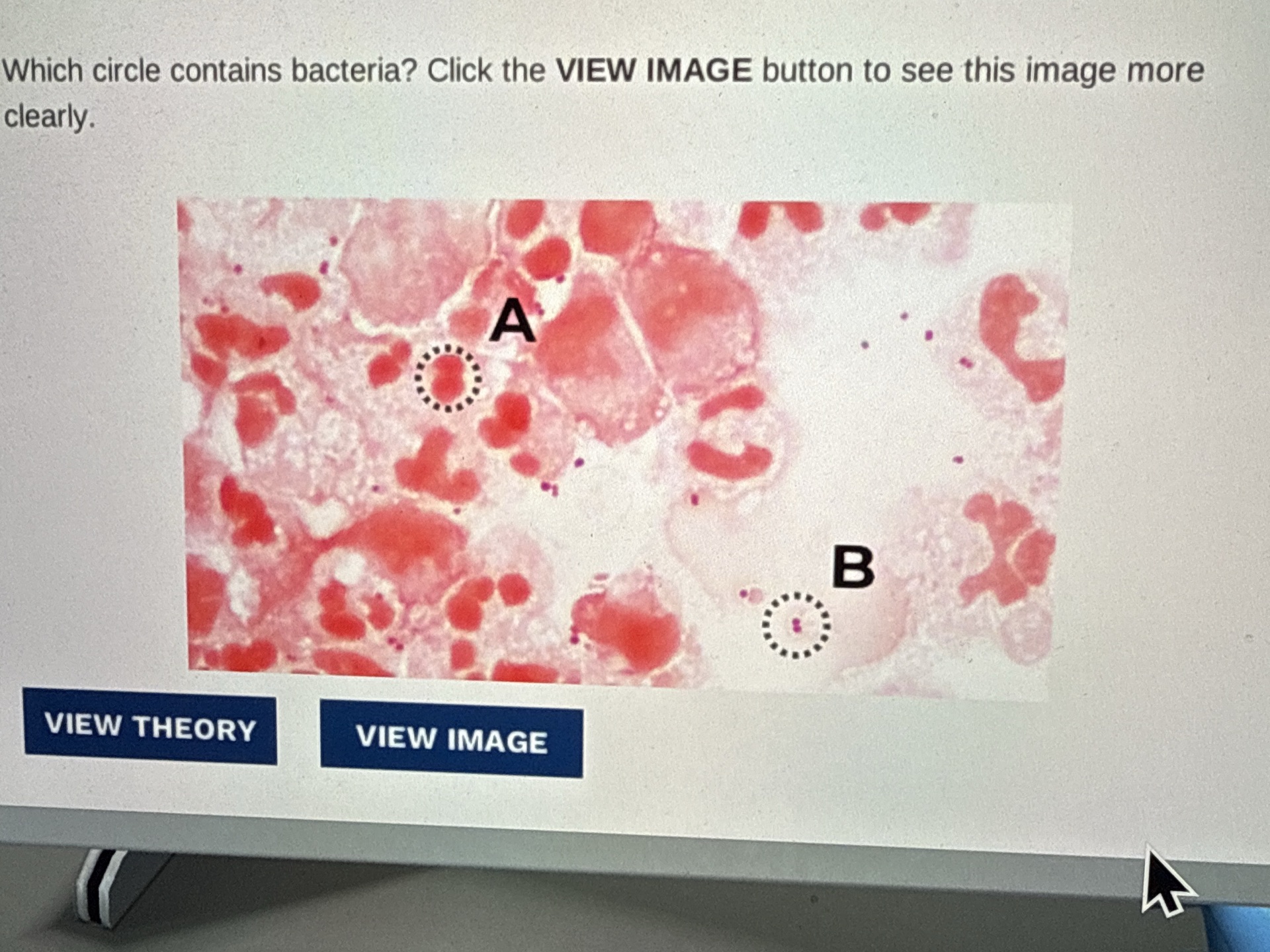 Identifying Bacteria in a Circle - Biology | StudyX