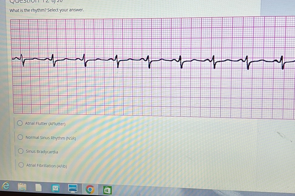 What is the rhythm? Select your answer. | StudyX
