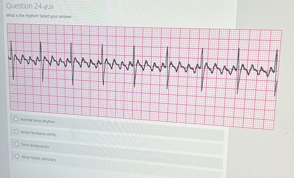 Question 24 of 25 What is the rhythm? Select | StudyX
