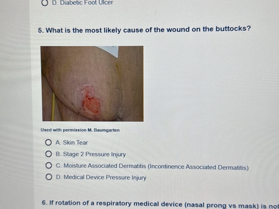 What is the most likely cause of the wound