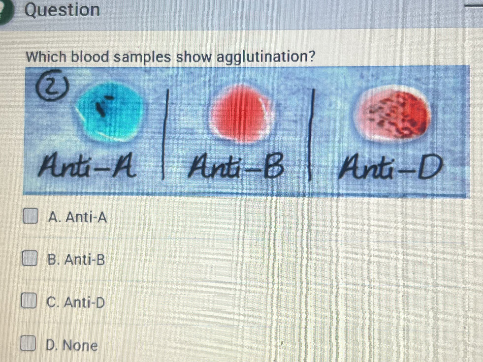 Which blood samples show agglutination? | StudyX
