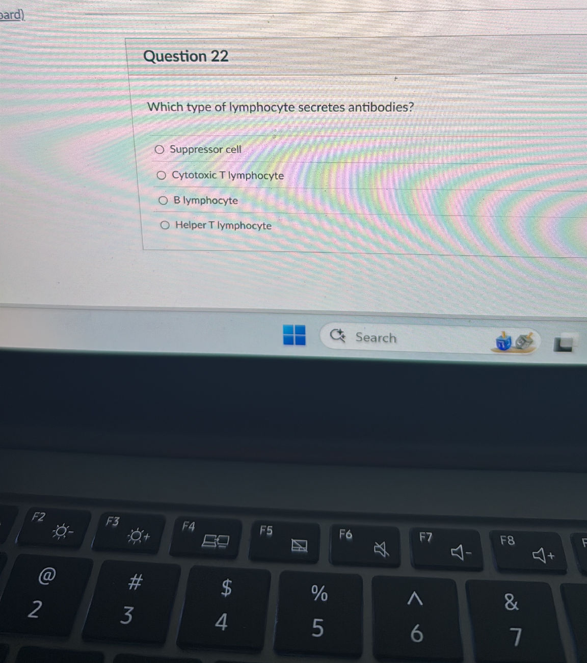 Question 22 Which type of lymphocyte | StudyX