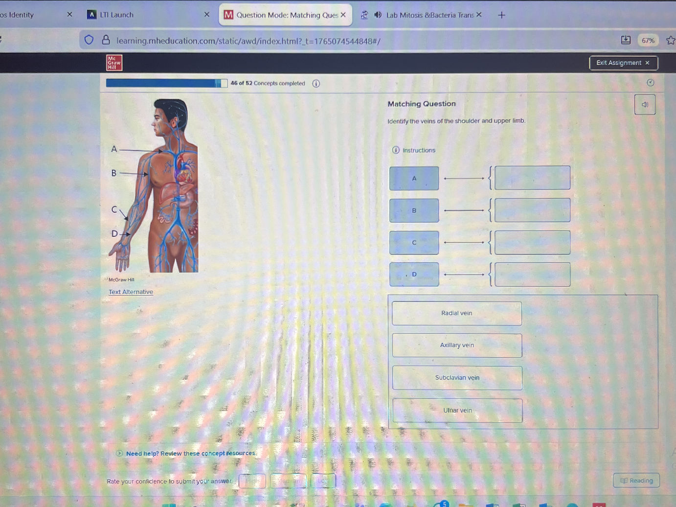 Matching Question Identify the veins of the | StudyX