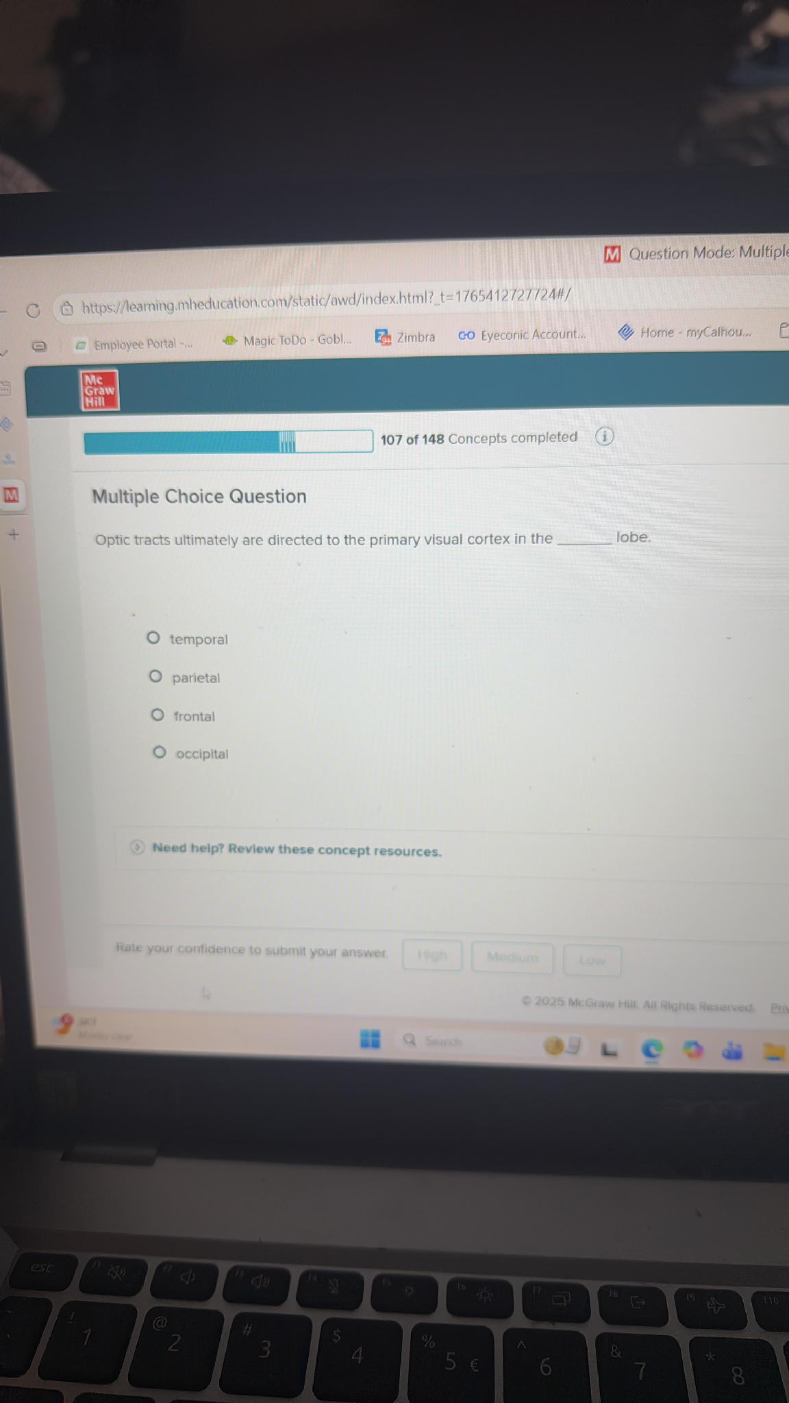 Multiple Choice Question Optic tracts | StudyX